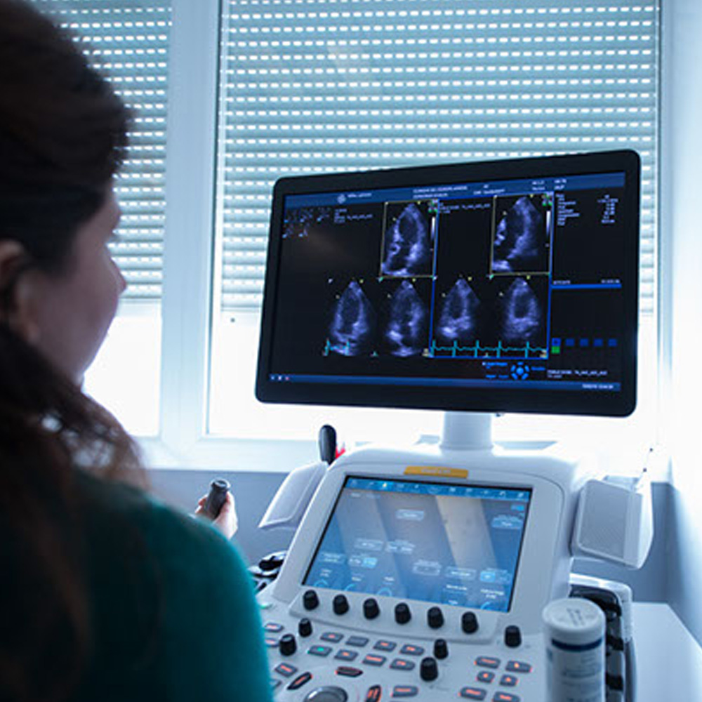 Test d'effort - Cardiologie du Pole des Cliniques d'Amiens